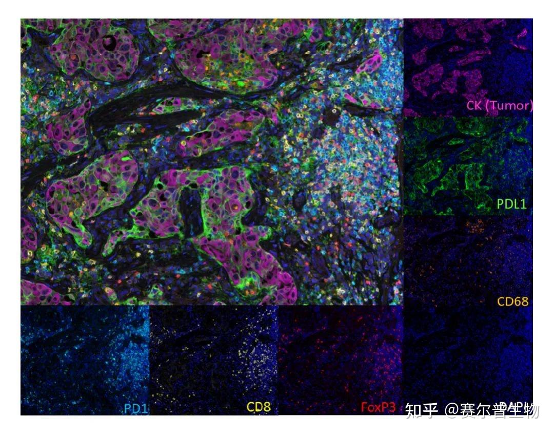 肿瘤免疫学研究新工具：多重免疫组化(mIHC) - 知乎
