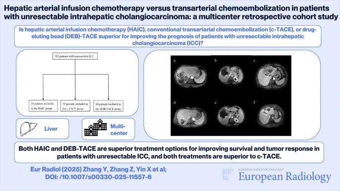 肝内胆管癌：HAIC和TACE，怎么选？ - 知乎