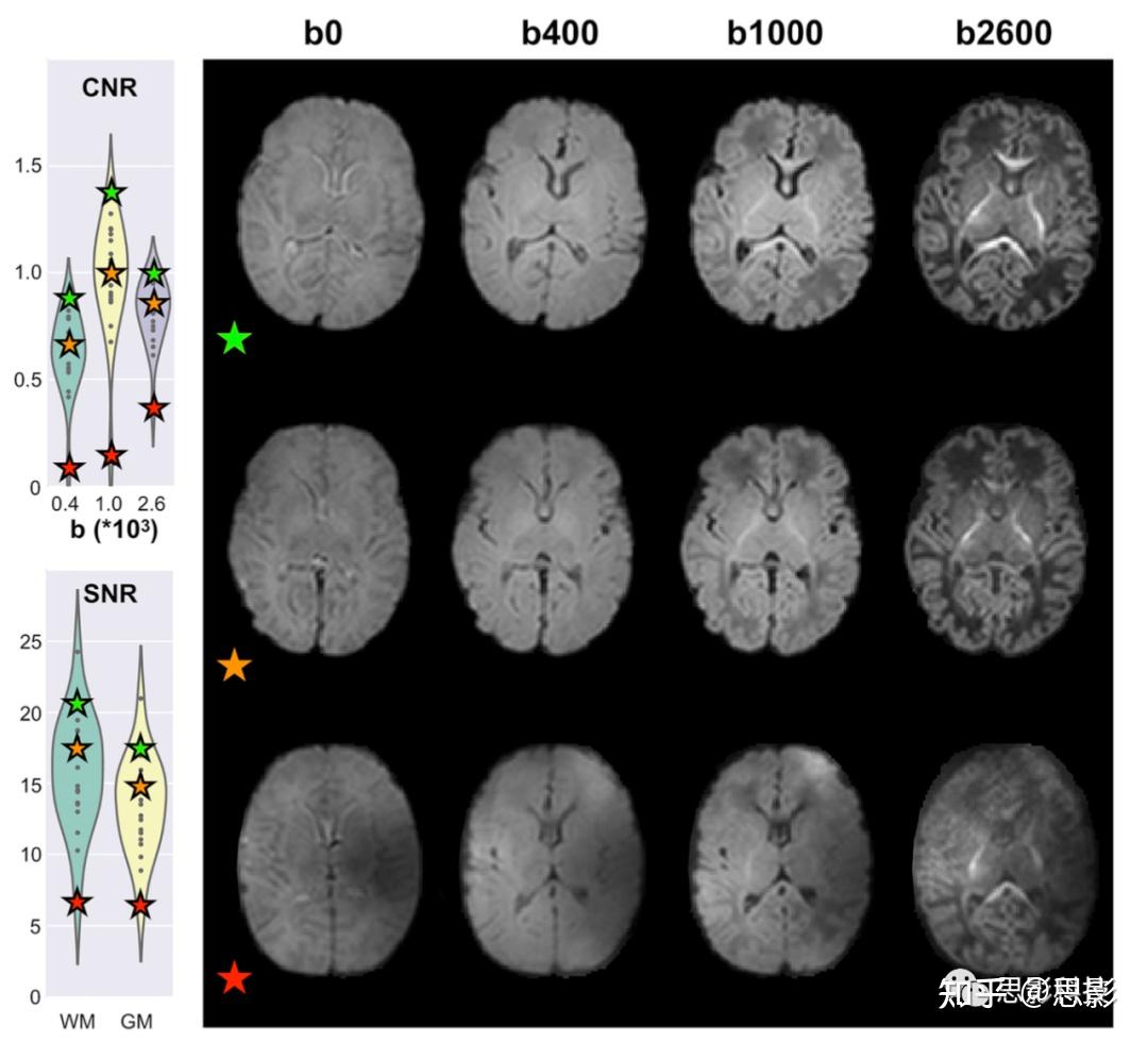 发展人脑连接组计划中（dHCP)婴儿扩散 MRI 的自动化处理流程 - 知乎