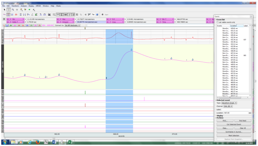 AcqKnowledge软件进行皮肤电反应（EDA/SCR）分析的详细教程 - 知乎