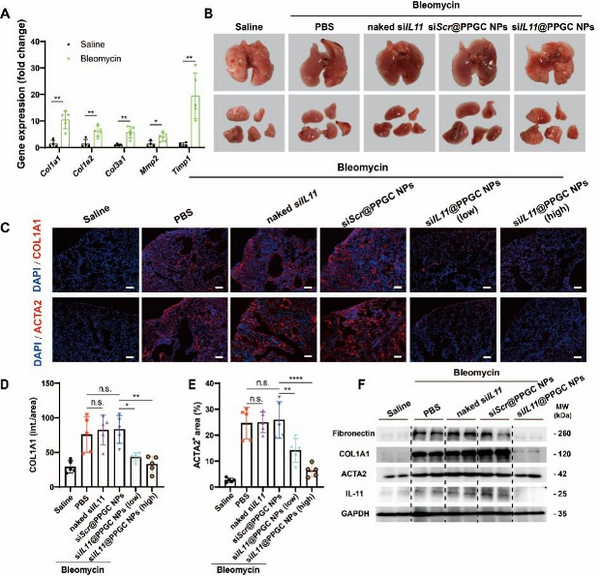 Sci Adv︱章雪晴/许晓阳团队利用新型吸入式核酸纳米递送系统治疗肺纤维化 - 知乎