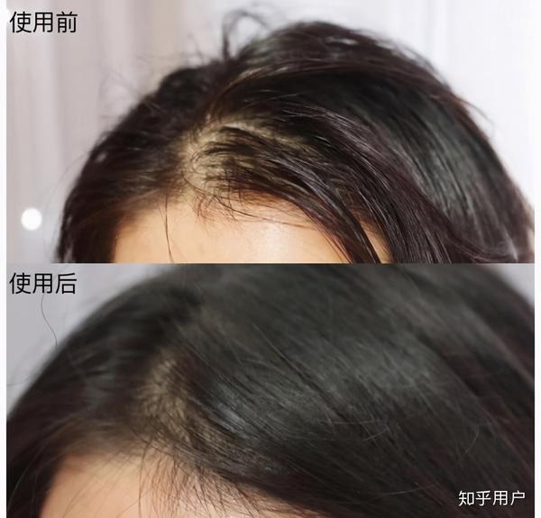 目前最好的防脱发洗发水推荐,容易掉头发用什么洗发水好?哪一款洗发水防脱发效果好? 知乎