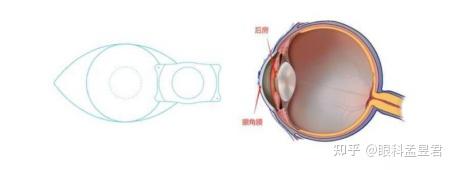 价格6万的ICL V5晶体植入究竟值不值得做？ - 知乎