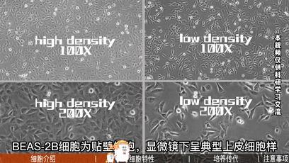 BEAS-2B细胞培养，人支气管上皮细胞培养攻略 - 知乎