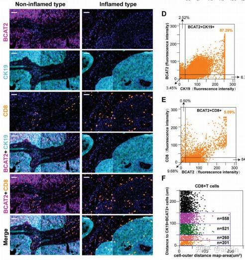 多色文献分享：BCAT2联合ICB——膀胱癌诊疗新思路 - 知乎