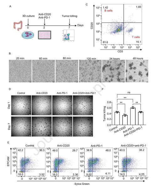 项目文章 | 单细胞测序揭示结直肠癌区域性免疫图谱和B细胞互作 - 知乎