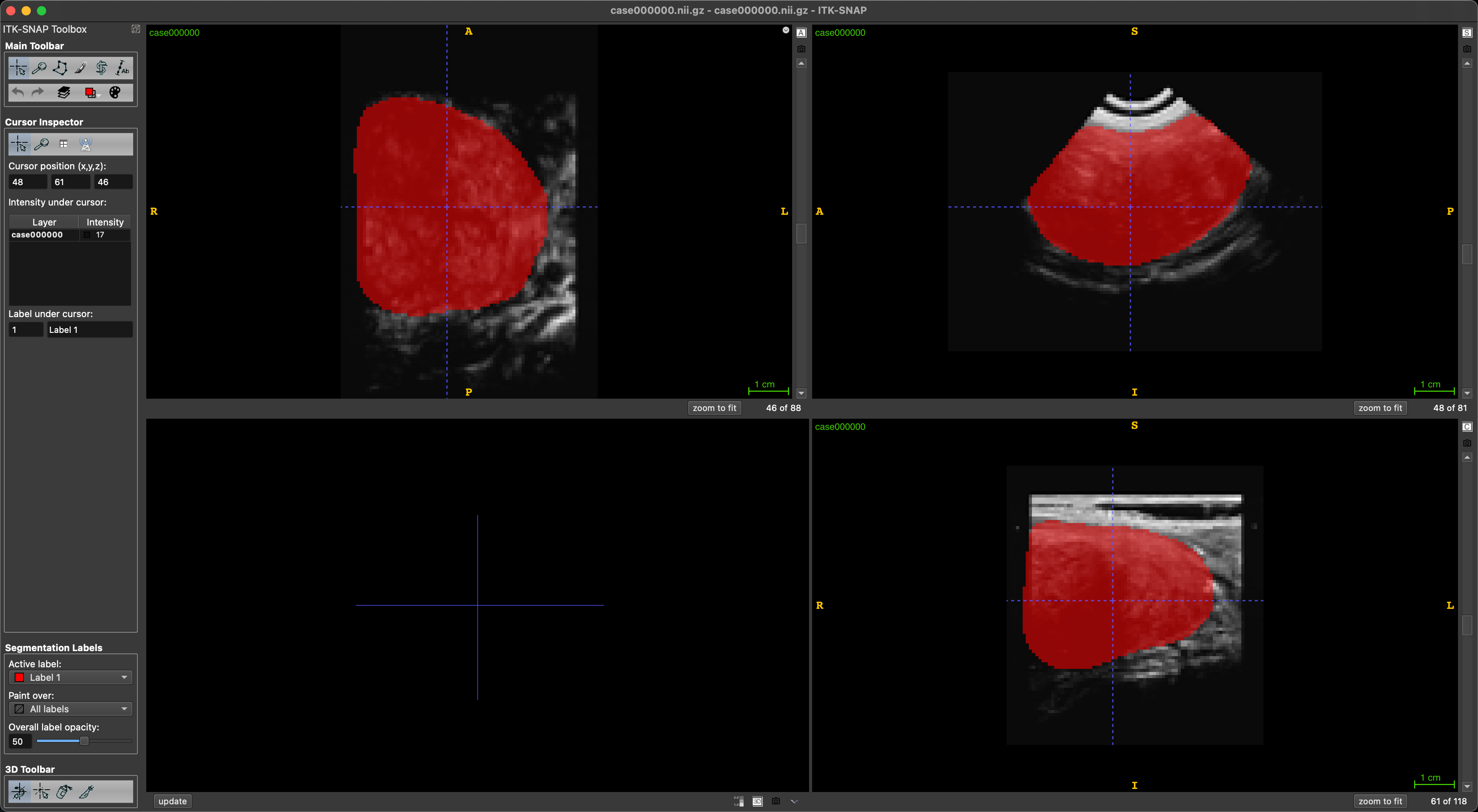 µ-RegPro 前列腺磁共振超声配准数据集介绍 - 知乎