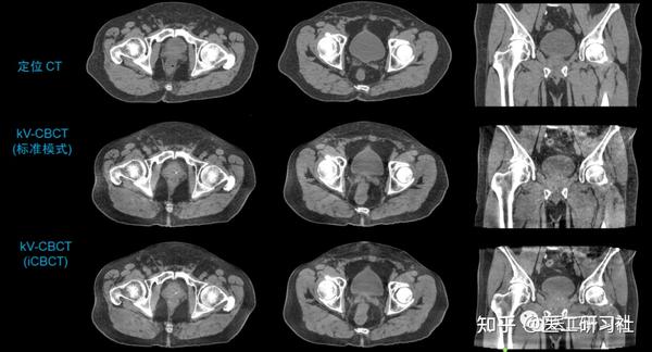 CBCT：不是CT，但也前途一片光明 - 知乎