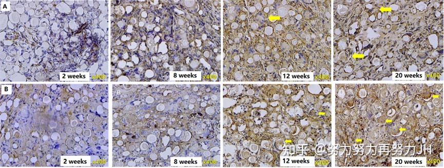 再生型注射针系列1：聚左旋乳酸 - 知乎