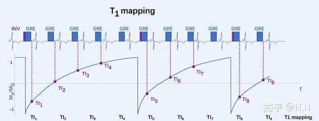 核磁共振影像T1/T2 fitting（matlab/python） - 知乎