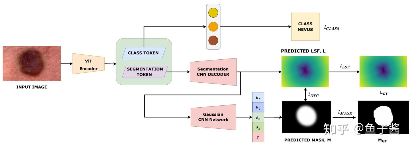 Transformer+UNet到底是谁想出来的点子！用来创新真的太绝了！ - 知乎