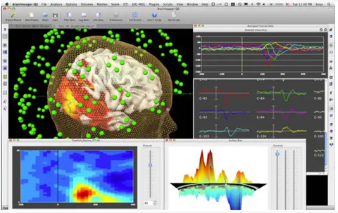 EEG数据：ERP预处理完整代码（包含资源下载） - 知乎