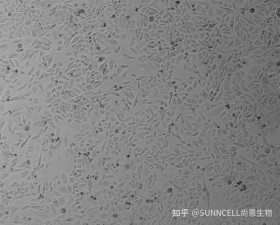 干货！！SK-LU-1（人低分化肺腺癌细胞）传代标准操作流程 - 知乎