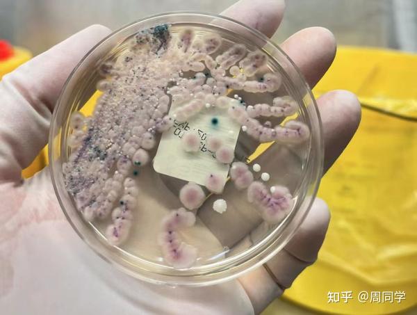 为什么我的私处一直瘙痒难忍? 知乎