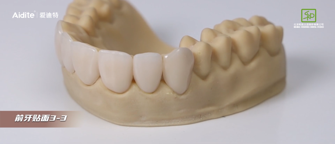 访谈 | 国内首家EZneer授权加工厂-北京和胜义齿 - 知乎