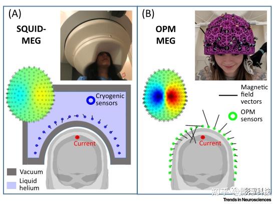 2022年第54期(Trends in Neurosciences)：光泵磁力仪脑磁图 (OPM-MEG) -下一代功能成像利器 - 知乎
