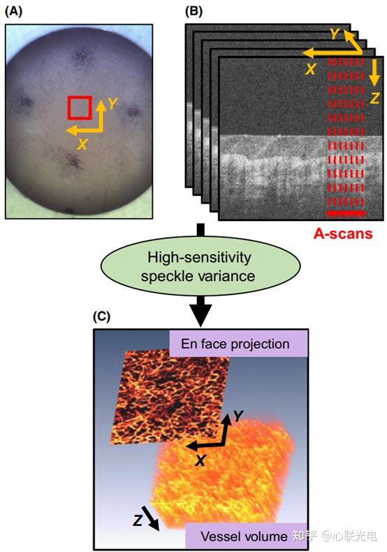 Skin Res Technol：使用OCTA研究皮肤对机械应力的适应性 - 知乎