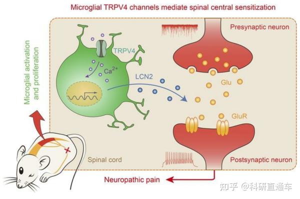 慢性疼痛难忍？胡宏镇团队揭示神经病理性疼痛新机制，发现新治疗靶点 - 知乎