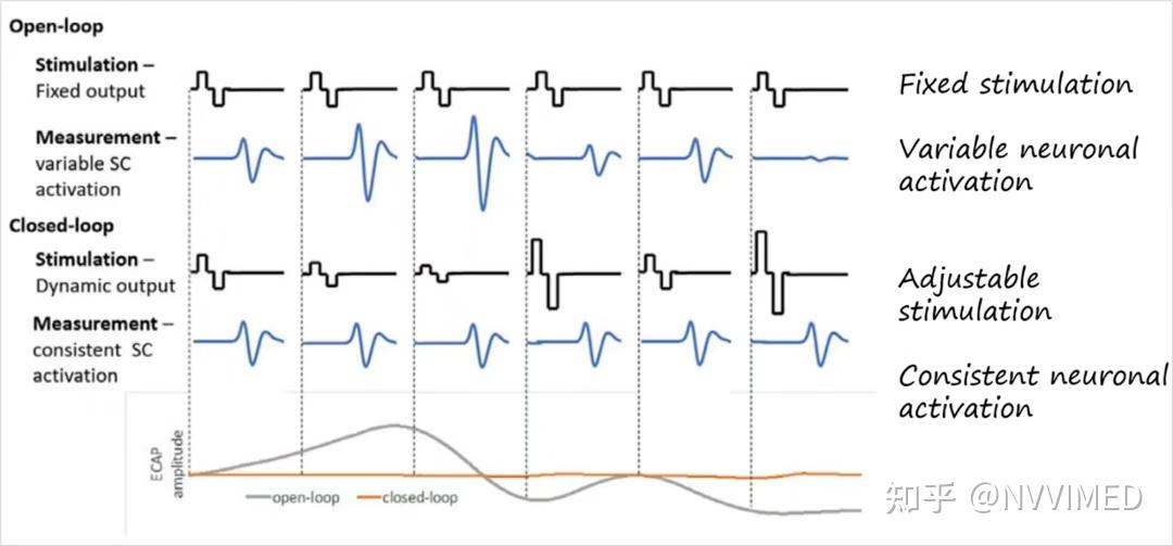 “闭环革命”来袭！脊髓电刺激SCS如何重构慢性疼痛治疗全球格局？ - 知乎