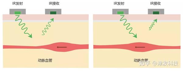 【津发科技】ErgoLAB-HRV来源-PPG与ECG的测量 - 知乎