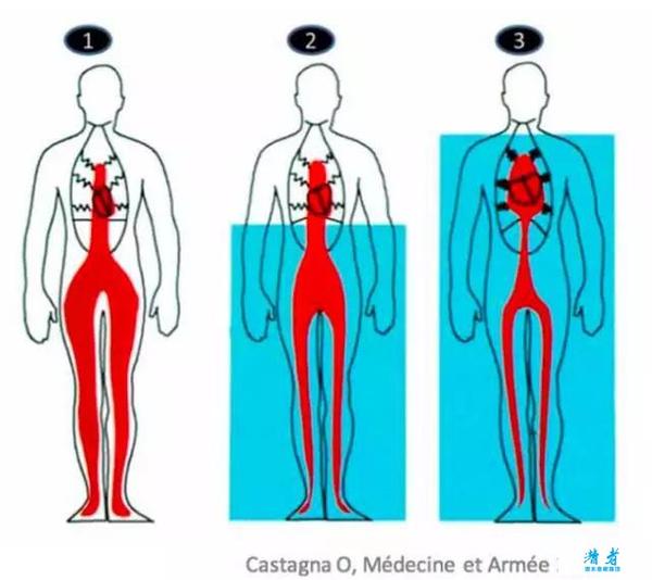 自由潜远离氮醉，多喝水行吗？ - 知乎