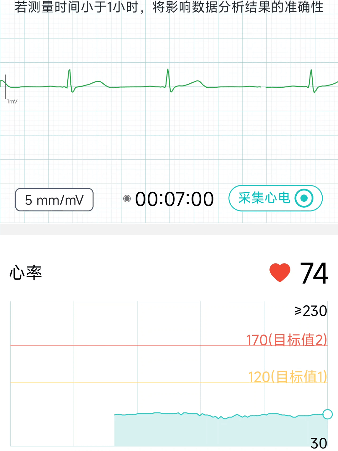 健康｜心脏问题需早发现早治疗，如何及时发现？乐普ER1有答案！ - 知乎