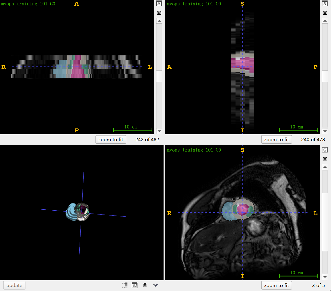 MyoPS 2020 数据集介绍 - 知乎