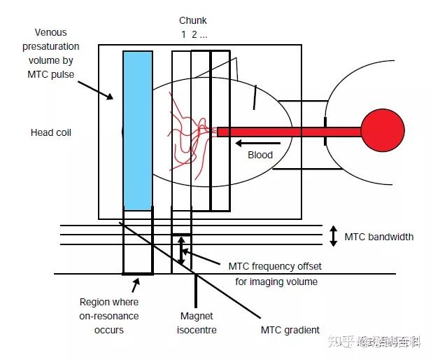 什么叫做磁化传递MTC？ - 知乎