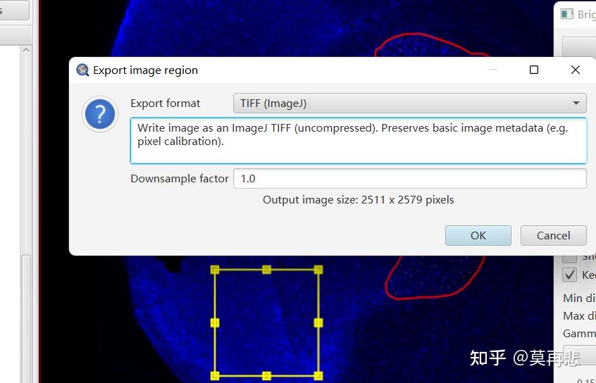 从零开始描述不规则细胞——基于cellpose（2.0）与stardist（qupath）的自动细胞分割及计算教程 - 知乎