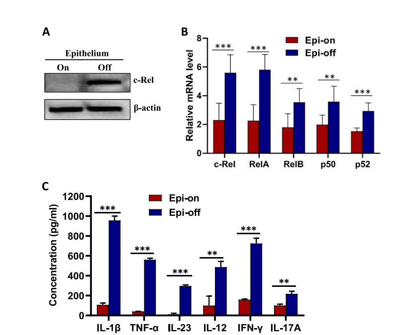 Inflamm Regen︱山东第一医科大学附属山东省眼科研究所阮庆国团队利用外泌体介导的靶向NF-κB c-Rel策略促进角膜损伤修复 - 知乎