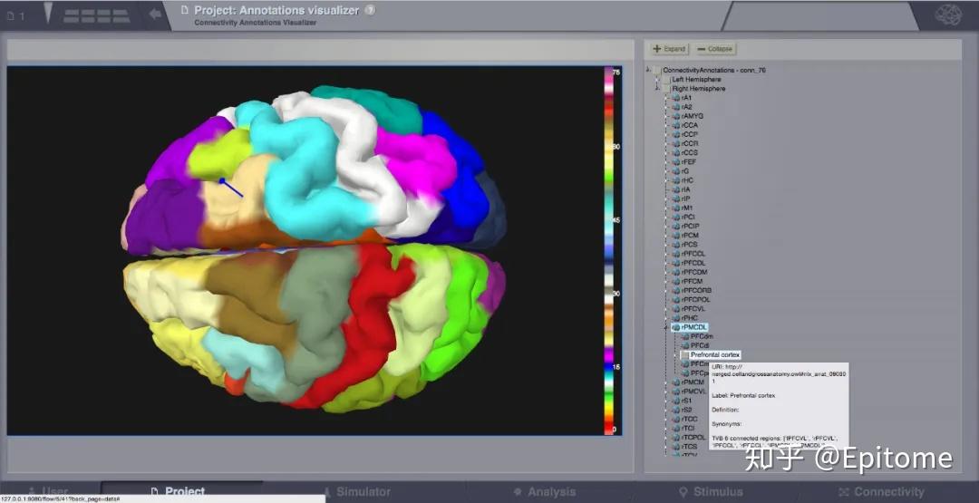 TheVirtualBrain: Brain Network Dynamics Simulator - 知乎