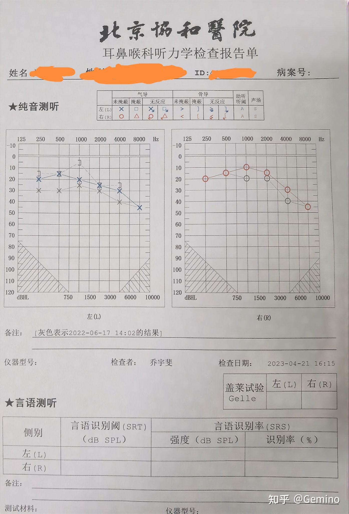 我的耳硬化症耳聋治疗经历（7）最新复查结果 知乎