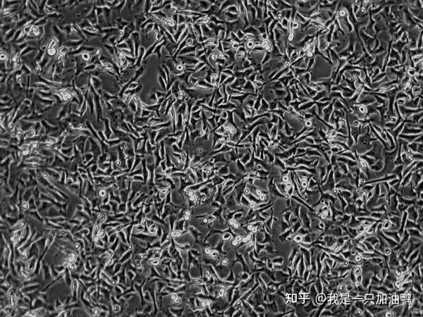 B16-F10(小鼠皮肤黑色素瘤细胞）细胞培养建议 - 知乎
