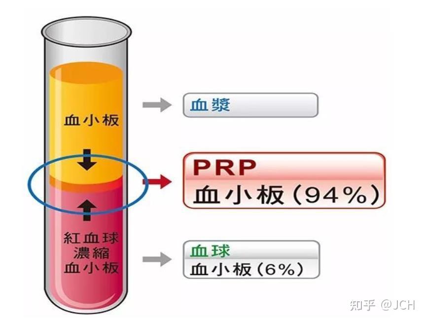 临床上所用的PRP、PRF和CGF都是血液制品，它们的区别在哪里？ - 知乎