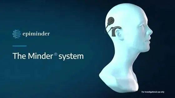 FDA批准！全球首款植入式脑电EEG监测系统，推动癫痫管理进入智能化时代 - 知乎