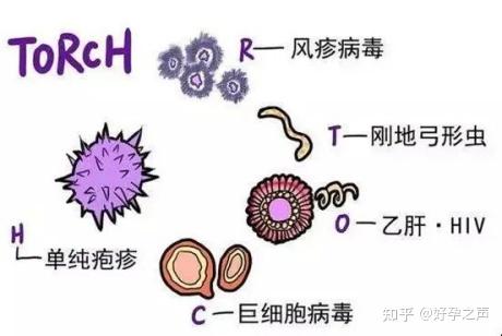 孕前检查之TORCH结果解读，检查哪些指标？如何解读？ - 知乎