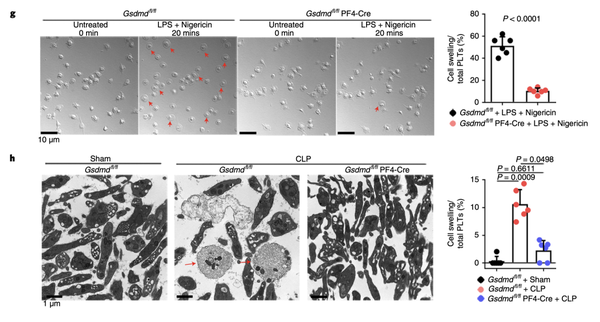 Nature最新大子刊丨脓毒症-血小板-GSDMD-NETs - 知乎