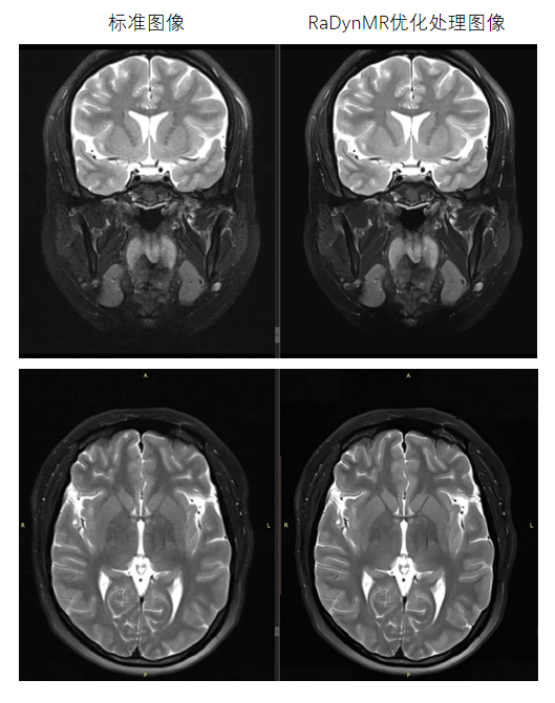 医学成像领域的奠基者系列——Dimitris Metaxas与分析心脏MRI图像的算法 - 知乎
