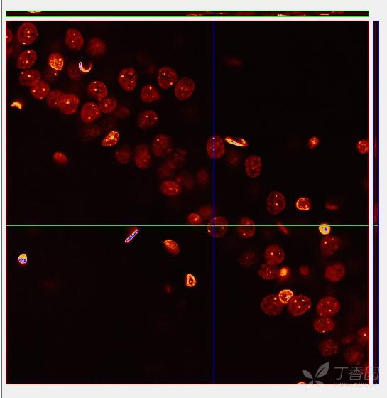 ImageJ的一些基本操作 - 知乎
