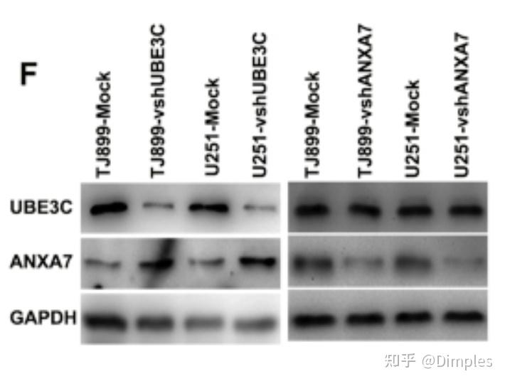 了解HECT家族E3 泛素连接酶 ——UBE3C - 知乎