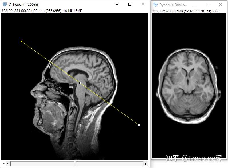 ImageJ实用教程——3D Stack Reslice(基本功能篇) - 知乎