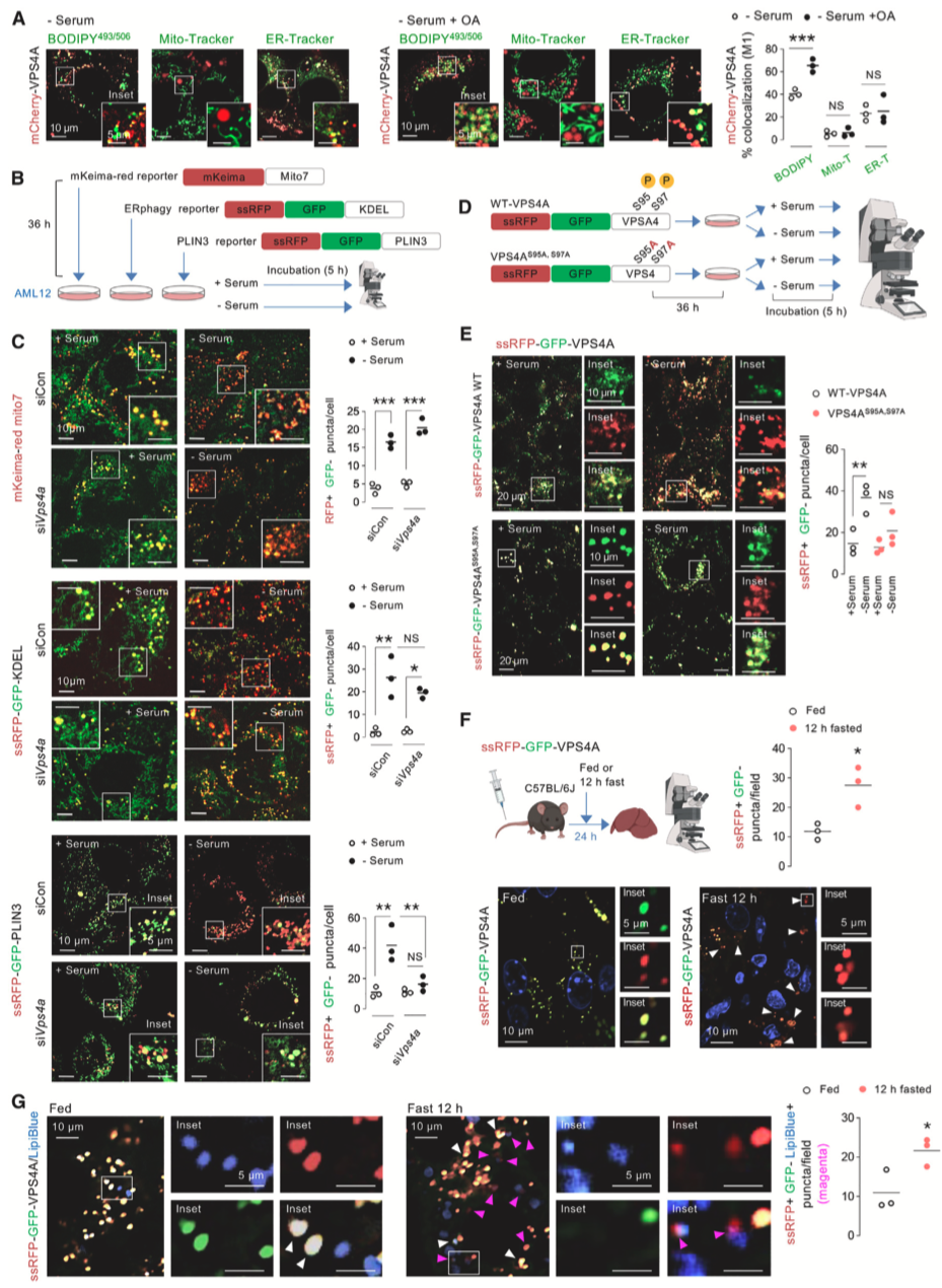 Molecular Cell丨VPS4A 是小鼠和人类脂噬的选择性受体 - 知乎