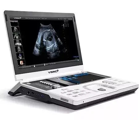 国内超声影像领域的“十大金刚” - 知乎