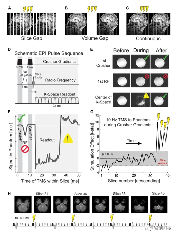 同步TMS-fMRI研究脑功能网络的指南 - 知乎