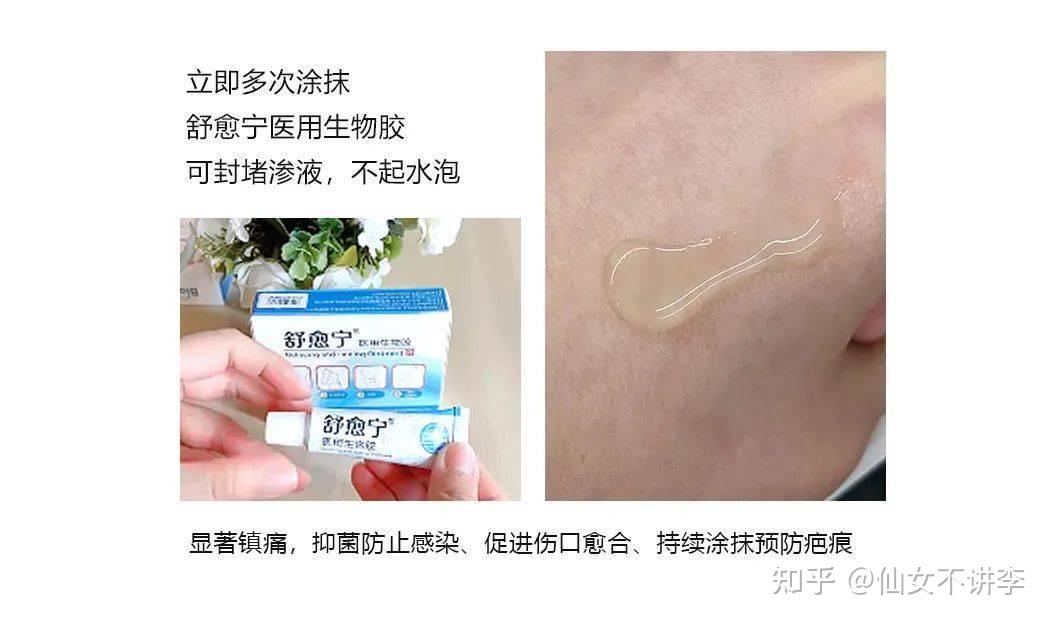 有孩子家庭烫伤后：第一时间怎么做？起泡了要不要挑？为孩子果断收藏~ - 知乎
