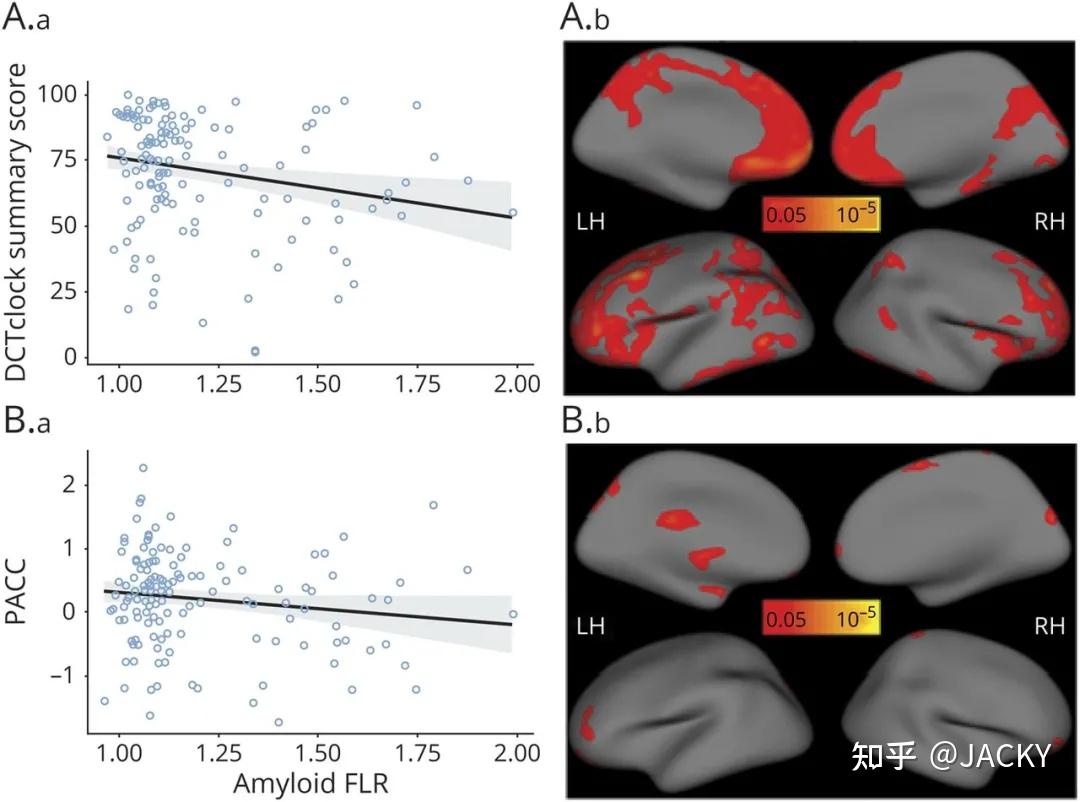 数字画钟测试可以在无症状个体中检测出阿尔茨海默病 - 知乎