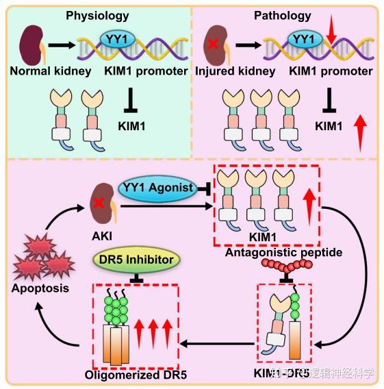 Nat Commun︱武汉大学郑凌/华中科技大学黄昆课题组联合发现肾脏YY1-KIM1-DR5轴调控急性肾损伤进展 - 知乎