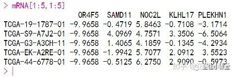 TCGA任意基因任意肿瘤，随意分析 - 知乎