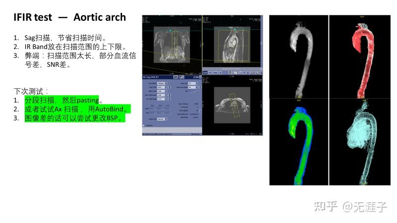 IFIR成像技术 - 知乎