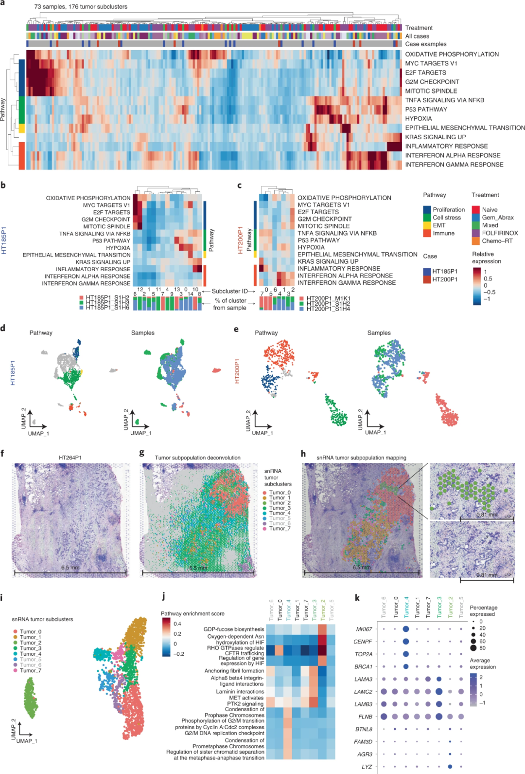 Nat Genetics | 胰腺癌肿瘤图谱网络连续动图揭示微环境与细胞亚群作用 - 知乎